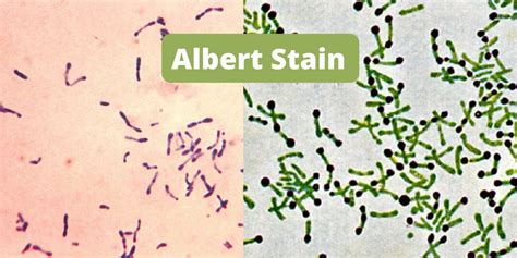 Types Of Stains Used In Microbiology Biology Notes Online