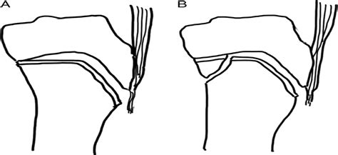Journal Of Pediatric Orthopaedics