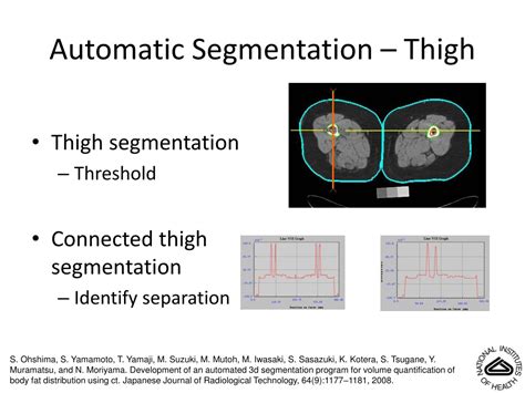 Ppt Automated Segmentation Of Computed Tomography Images Powerpoint