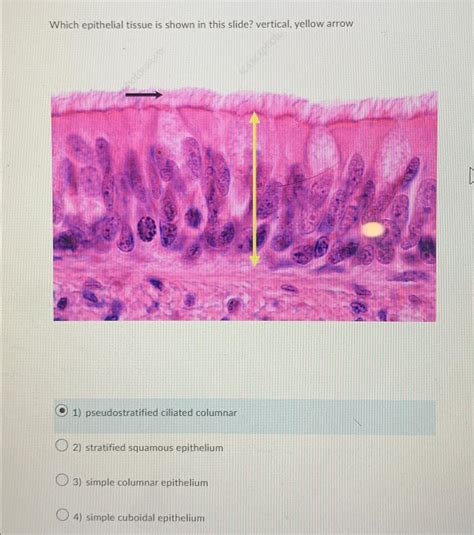 Solved Which Epithelial Tissue Is Shown In This Slide