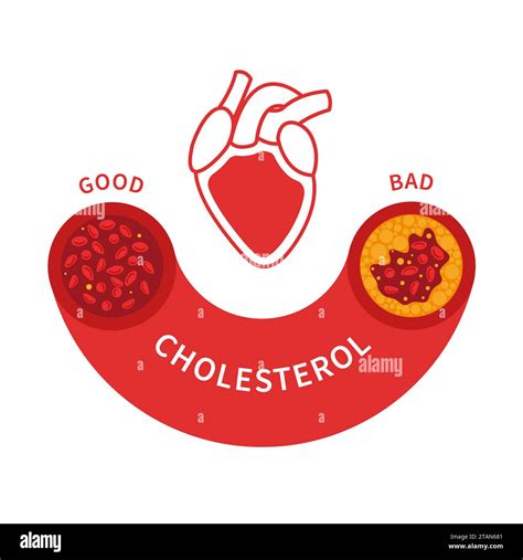 Cholesterol Levels