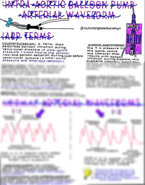 Intra Aortic Balloon Pump Iabp Waveforms Etsy