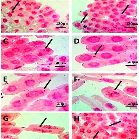 All Types Of Chromosomal Abnormalities Were Scored During Cytological