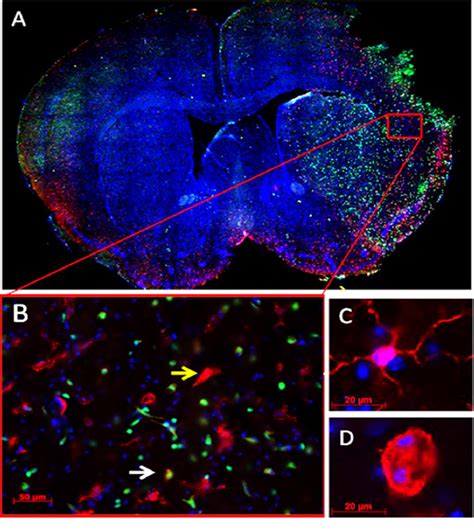 Figure 1 From Microglia And Ischemic Stroke A Double Edged Sword