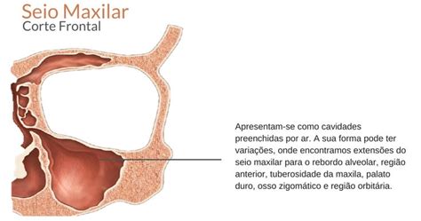 Anatomia Da Maxila Odontoup Anatomia Da Cabeça Anatomia Seio Maxilar