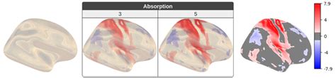 Comparison Of Fmri Statistical Maps A Cortical Surface With Horizons