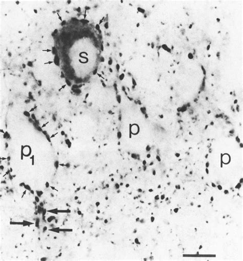 Light Micrograph Of Section Of Cat Visual Cortex Processed To Show