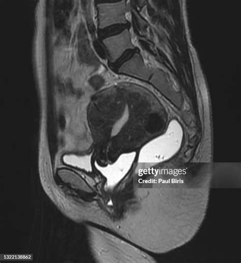 Mri Stomach Photos And Premium High Res Pictures Getty Images