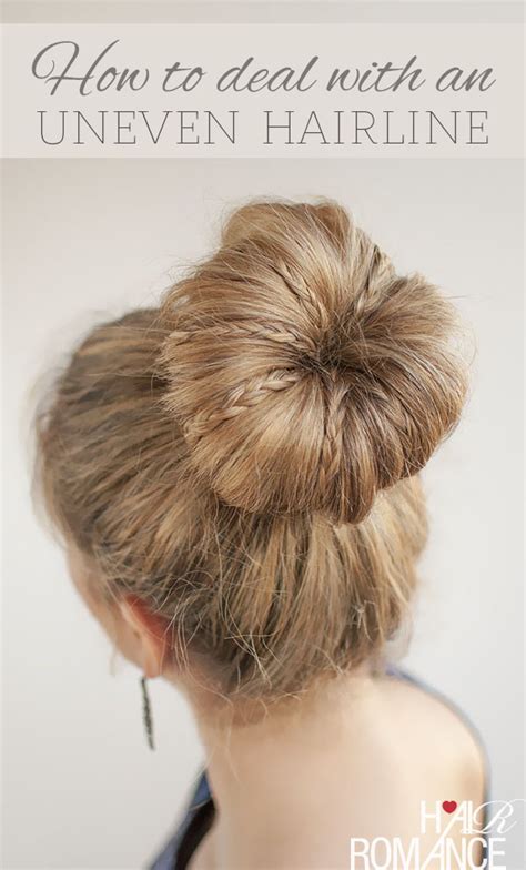 Reader Question How To Deal With An Uneven Hairline Hair Romance