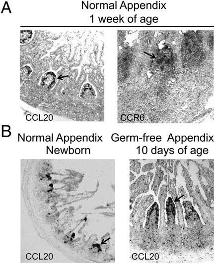 Ccl20 Ish And Ccr6 Immunohistochemistry Of Rabbit Appendix A