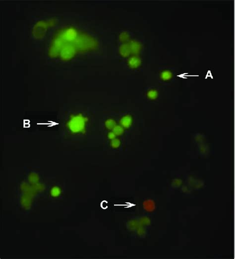 Standard Staining With Ethidium Bromide And Acridine Orange Ebao