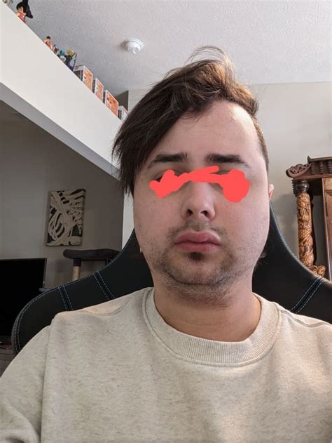 31m How Fucked Up Is My Face Is Mewing A Lost Cause For Me R Mewing