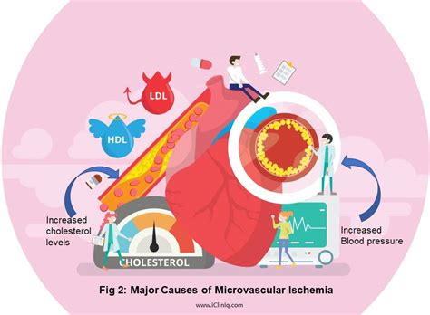 What Is Vascular Ischemic Disease At Amber Letters Blog