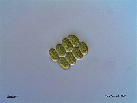 Protococcus Under Microscope