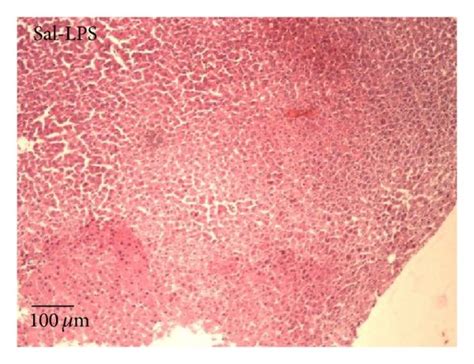 Effects Of F Chiloensis Supplementation In Liver Morphology After Lps Download Scientific