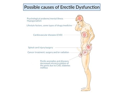 Erectile Dysfunction Andrology Awareness Europe