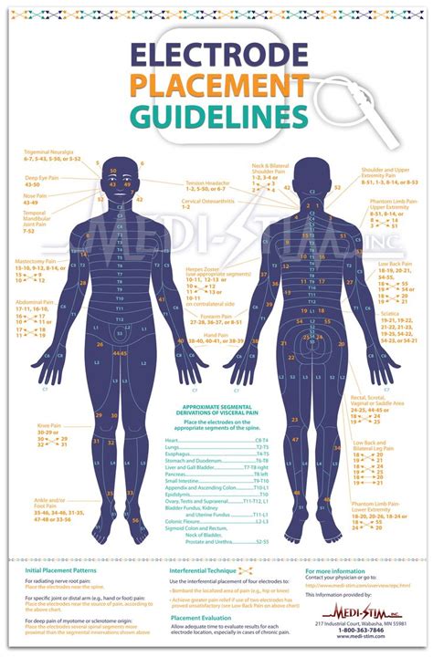 Electrode Placement Chart For Tens Unit Educational Chart Resources