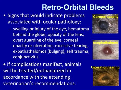 Ppt Retrobulbar Injection And Retro Orbital Bleeds Powerpoint