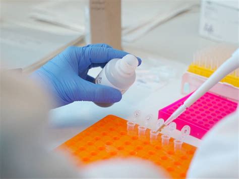 Chip Sequencing Eurecat Labs