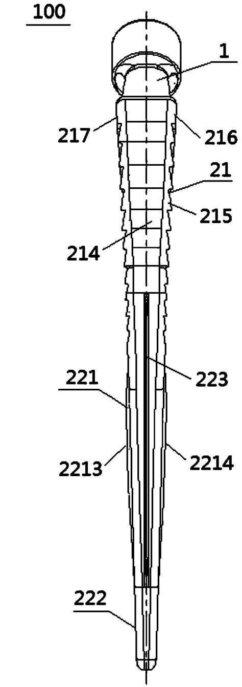 Femoral Stem Prosthesis Patented Technology Retrieval Search Results