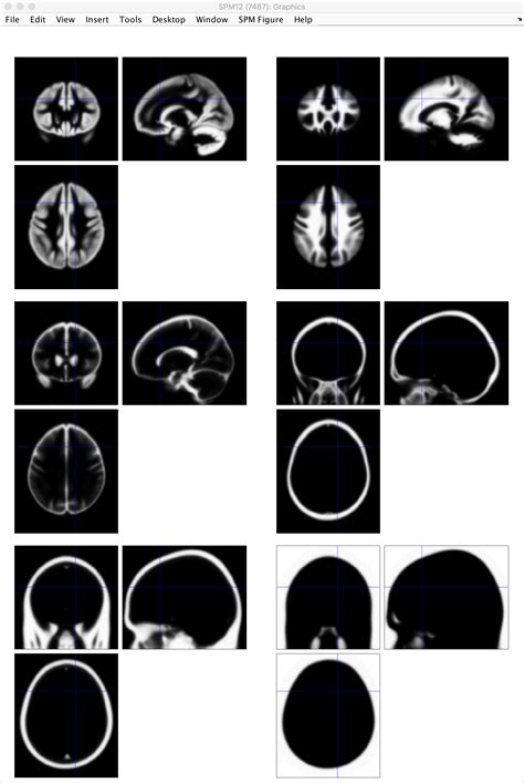 chapter 4 segmentation — andy s brain book 1 0 documentation