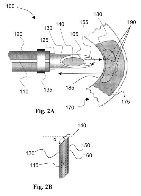 First Myocardial Infarction Patented Technology Retrieval Search Results Eureka Patsnap