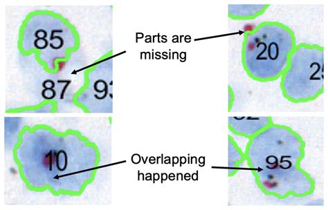 False Positives Of Singular Nuclei Which May Lead To Inaccurate Signal