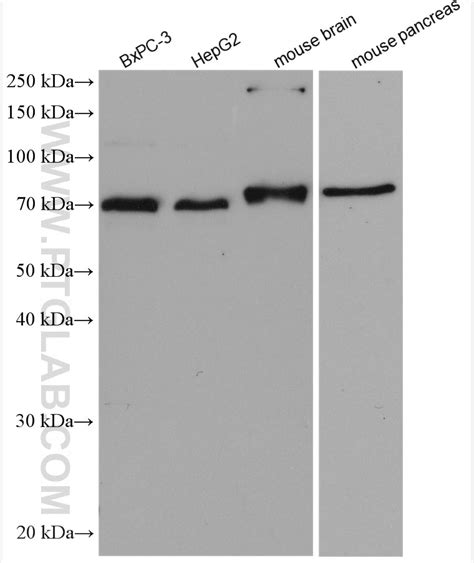 Grb10 Antibody 28872 1 Ap Proteintech