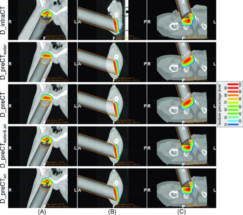 Dose Distributions Calculated Using The Monte Carlo Algorithm A