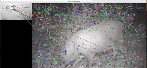 Resultant Image Of Surf Based Feature Description And Feature Matching Download Scientific Diagram