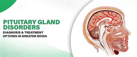 Pituitary Gland Disorders Diagnosis And Treatment Options In Greater Noida