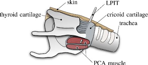 Figure 1 From Smart Artificial Soft Tissue Application To A Hybrid