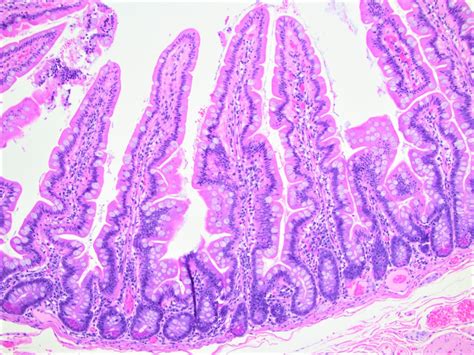 Ileum Microscope Slide Labeled At Natalie Axon Blog