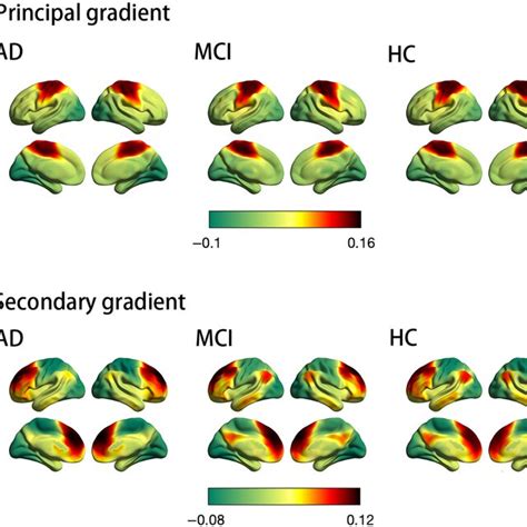 Whole‐brain Voxel‐level Secondary Gradient Comparisons Among The