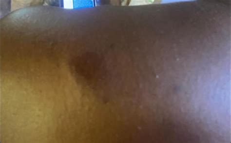 Ana Augustine Ana Augustine Added A New Photo