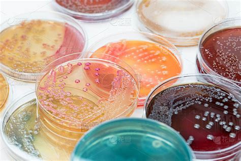 菌落在选择性培养基上生长。