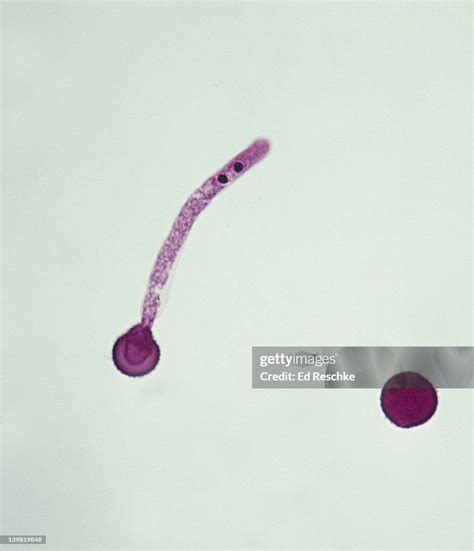 Germinating Pollen Grain With Pollen Tube Sperm 100x At 35mm Shows A