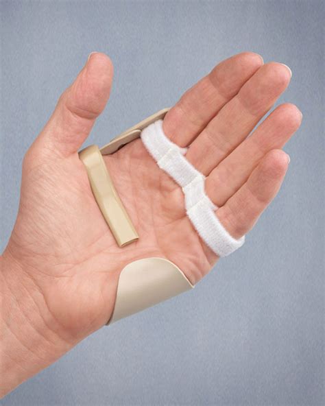 Radial Hinged Ulnar Deviation Splint
