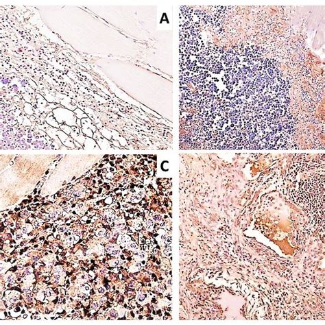 Dual Roles Of 4 Hne In Tumorigenesis Download Scientific Diagram