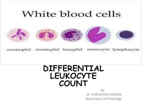 Differential Leukocyte Count