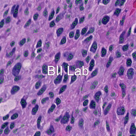 Ellipse Fitting Demo