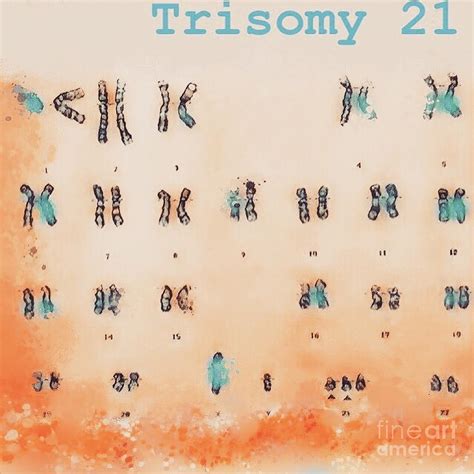 Trisomy Chromosome