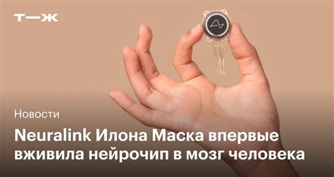 Neuralink Илона Маска впервые вживила нейрочип в мозг человека