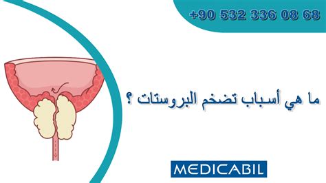 جراحة المسالك البولية مستشفى ميديكابيل الخاص