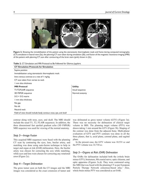 Rose Case Glomus Jugulare Pdf
