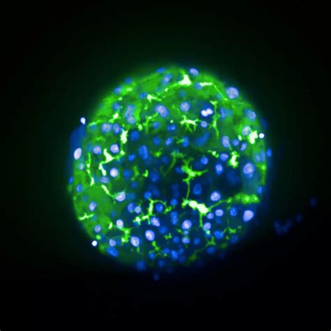 Physiological Model Solutions Revvity