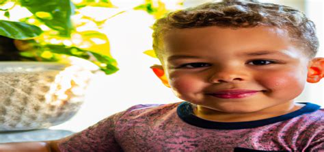 What You Need To Know About Schopf Schulz Passarge Syndrome