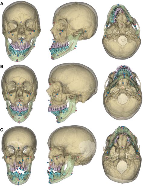 Figure 3 From Automatic Three Dimensional Cephalometric Landmarking Via Deep Learning Semantic