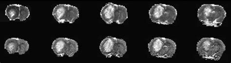 Representative Relative Cbv Maps Generated From D R 2 And D R 2 For