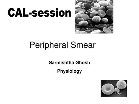 PPT Peripheral Smear PowerPoint Presentation Free Download ID